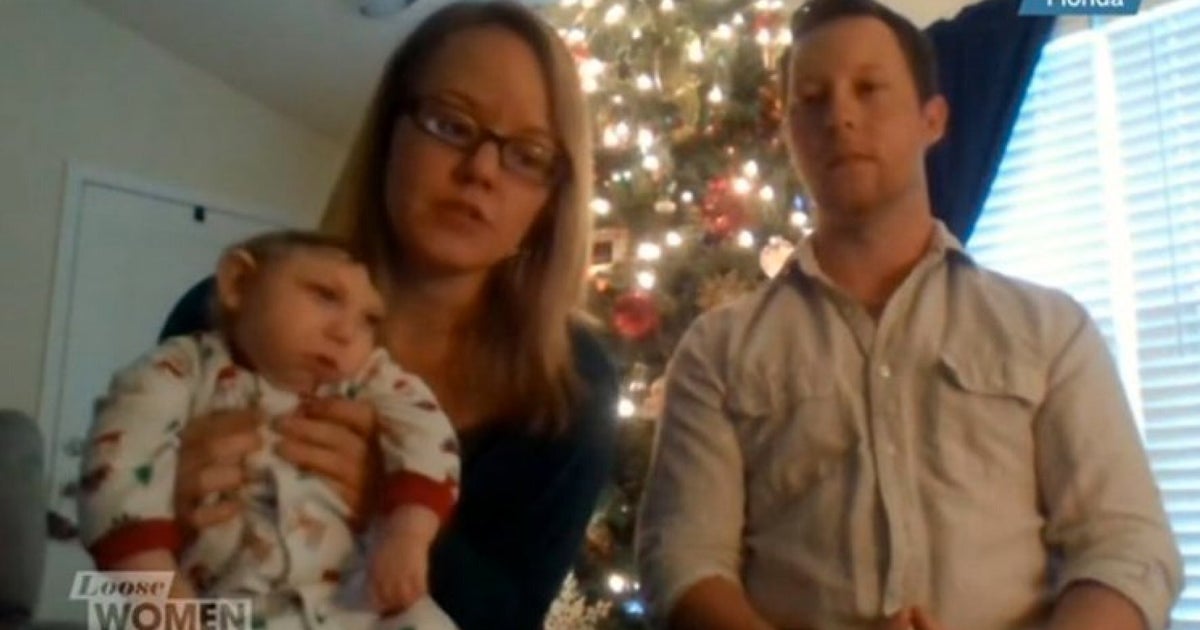 Parents Of Baby Jaxon Buell Born With Parts Of Skull Missing ...