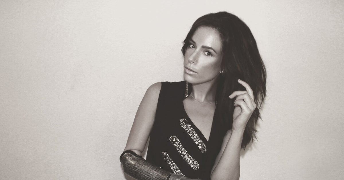 Rebekah Marine, Model With Bionic Arm Talks To Us About Walking At New ...