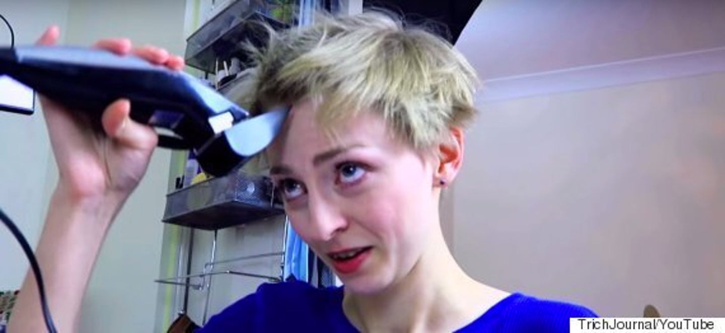 Woman With Hair-Pulling Condition Trichotillomania Shaves Head In Brave ...