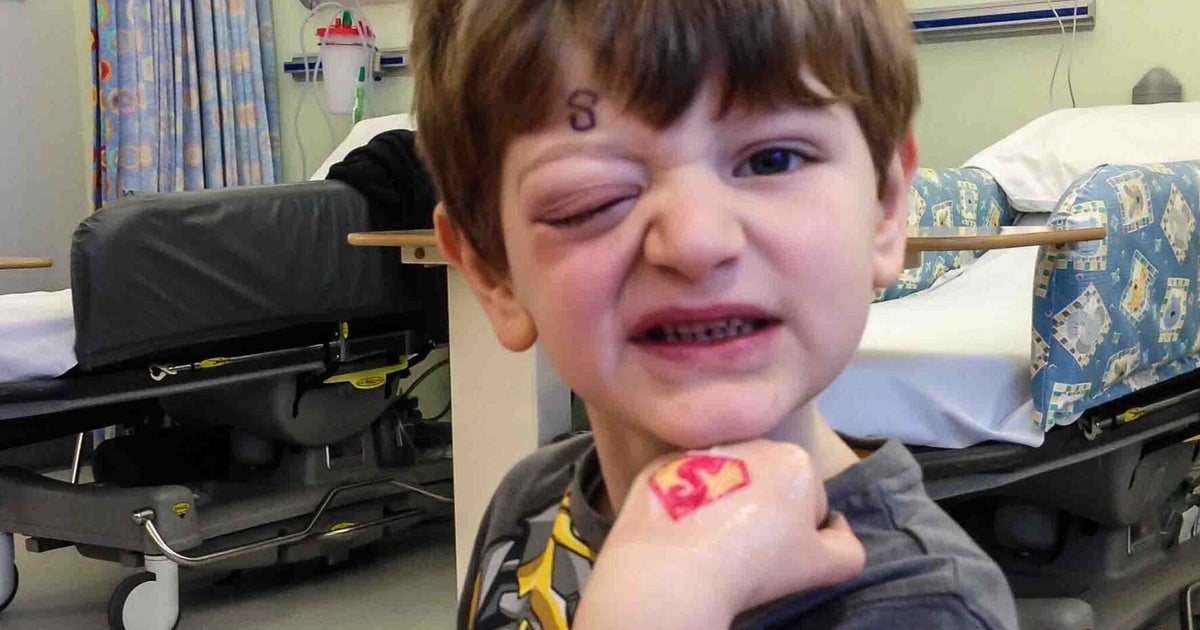 How Being Hit In The Eye Alerted Doctors To Five-Year-Old Boy's Life ...