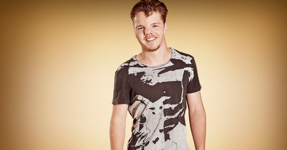 'The Undateables': Lucas Hayward On Living With Facial Dysplasia And ...