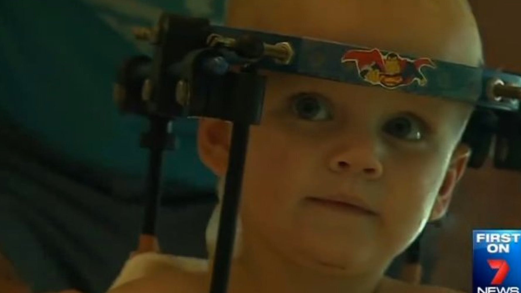 Doctors 'Reattach' Toddler's Head After Head-On Car Crash Caused By ...
