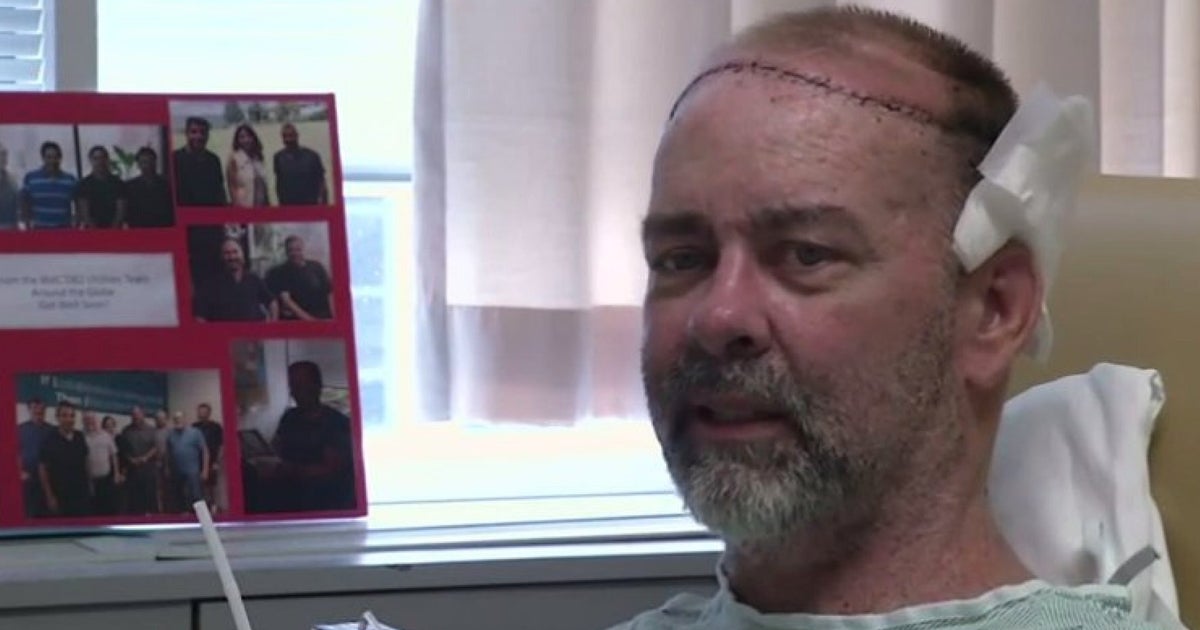 World's First Skull And Scalp Transplant Patient On Surgery Success: 'I ...