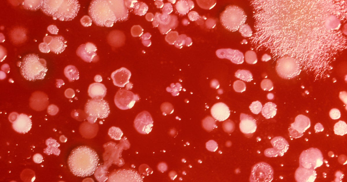 Anthrax Discovered In Wiltshire Cow As Public Health England Urge Calm Saying Human Infection