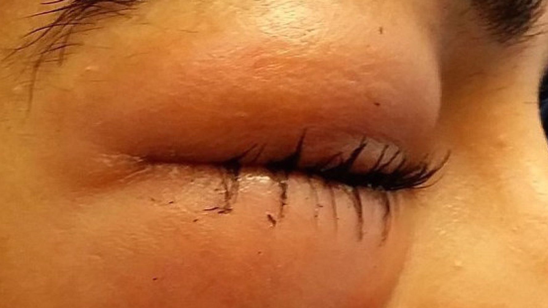 Waking Up With Swollen Eyes Sale Discounts Save 61 Jlcatj gob mx waking-up-with-swollen-eyes-sale-discounts-save-61-jlcatj-gob-mx
