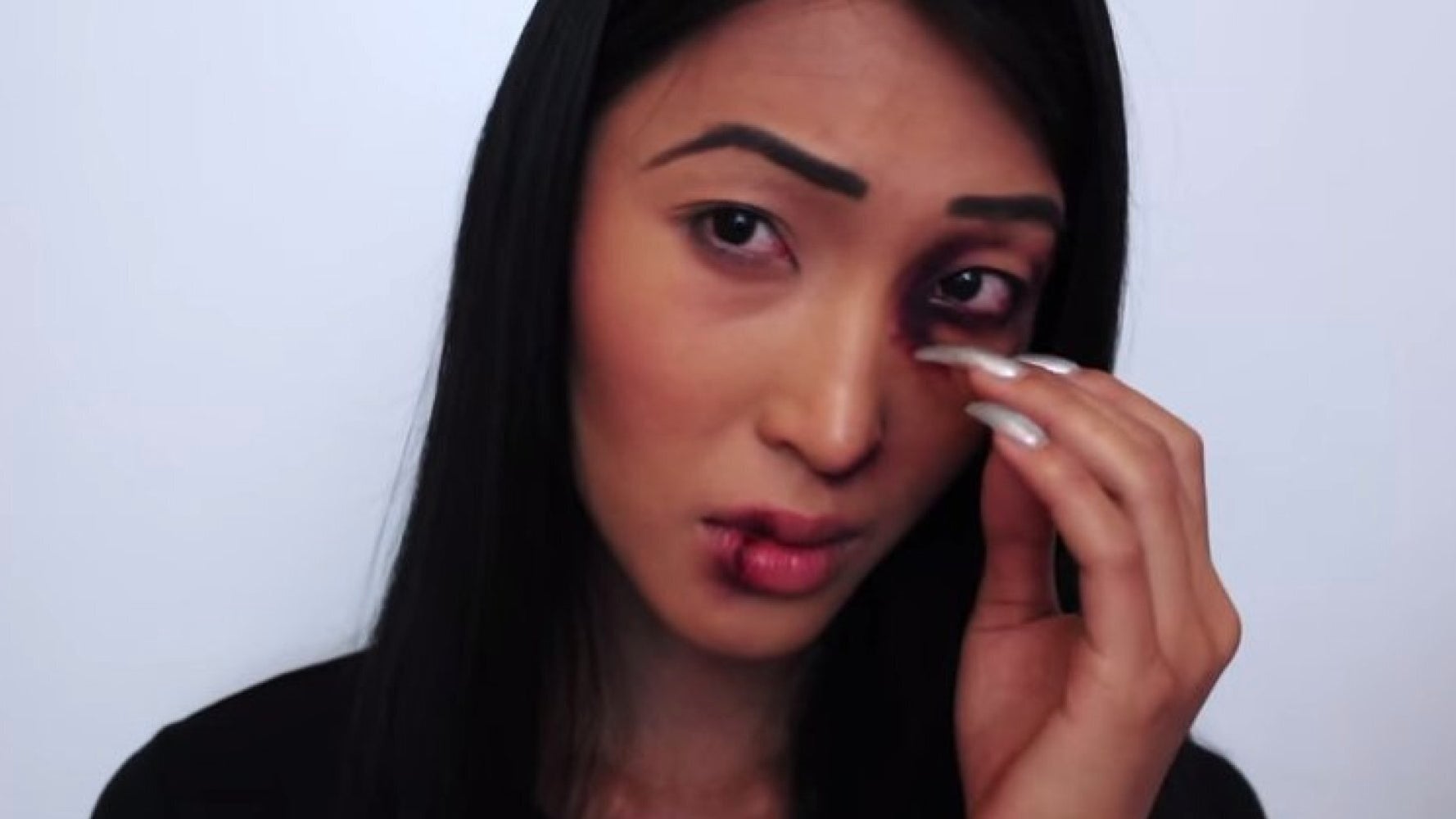 Transgender YouTube Star Proves Domestic Violence And Abuse 'Can Happen ...