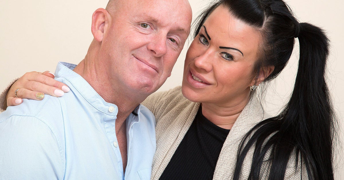 Woman With Plastic Surgery 'Addiction' On How It Nearly Destroyed Her ...