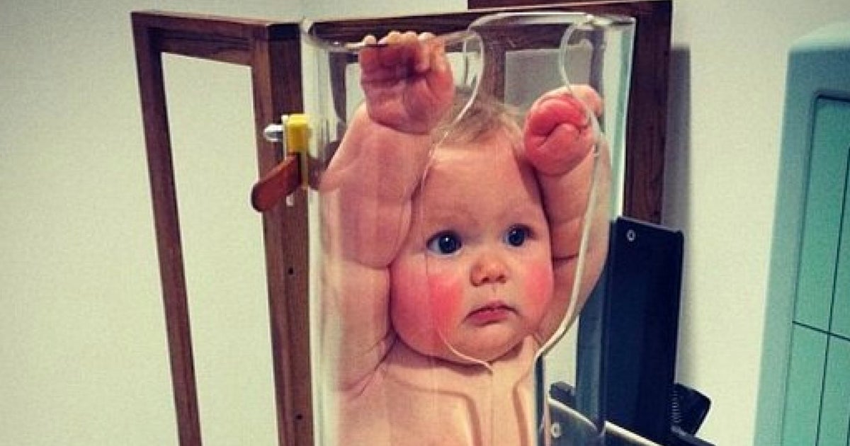 The Internet Goes Crazy After Seeing This Bizarre Baby X-Ray Device ...