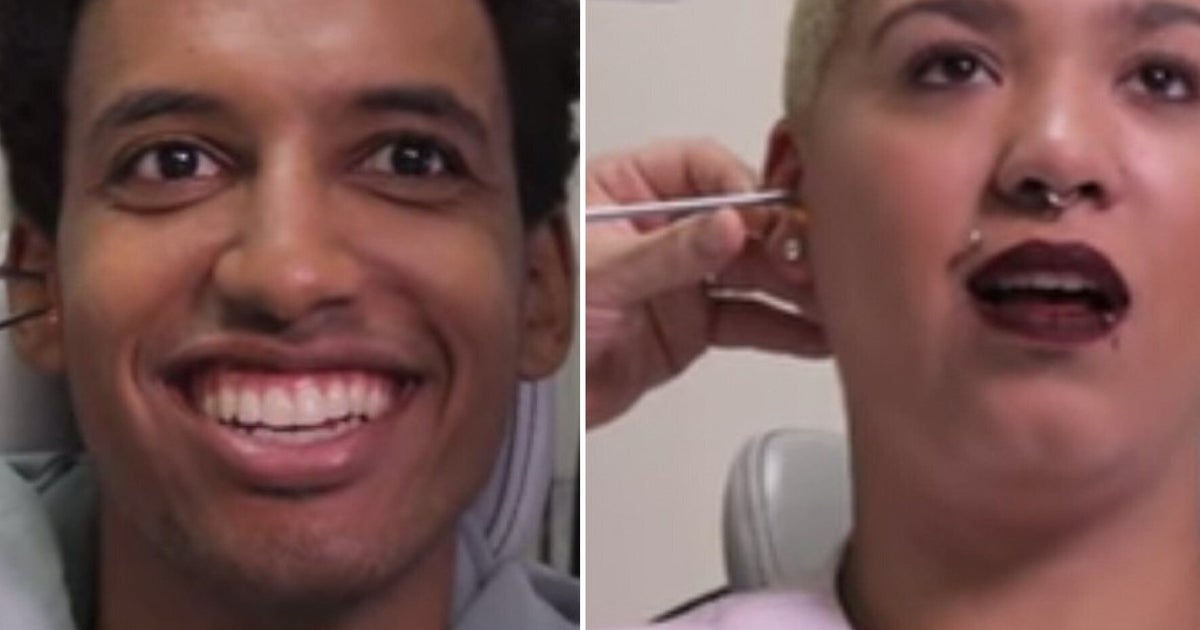 Video Shows People Getting Their Ear Wax Syringed, The Results Are ...