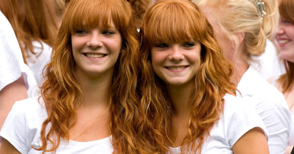 'Ginger' Parties Held In Lyon, France To Save Diminishing Redhead ...
