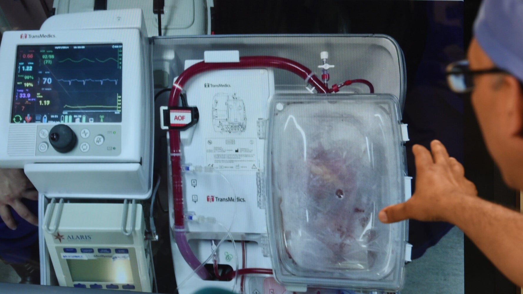Dead Heart Is Transplanted Into Living Body | HuffPost UK Tech