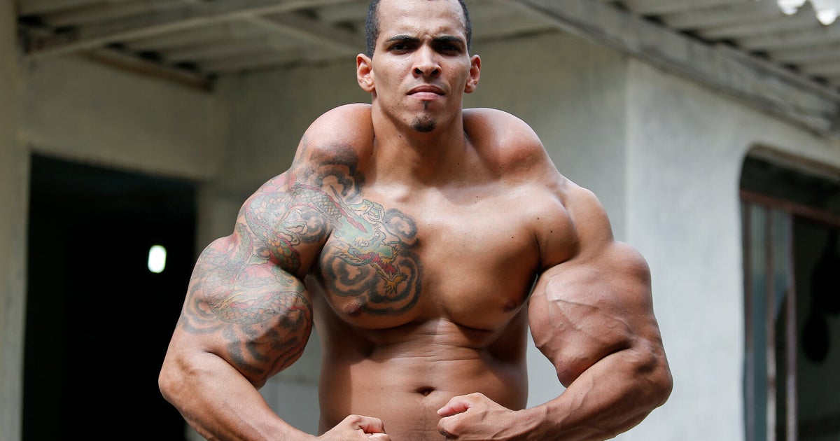 'Incredible Hulk' Bodybuilder On Life-Threatening Addiction: 'I Could ...