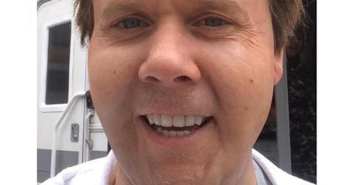 Kevin Bacon Looks Unbelievably Different With Prosthetics On His Face ...