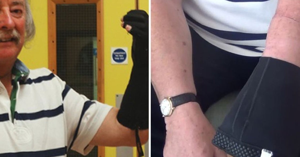 Neighbours Saved Man's Severed Hand After He Accidentally Cut It Off ...