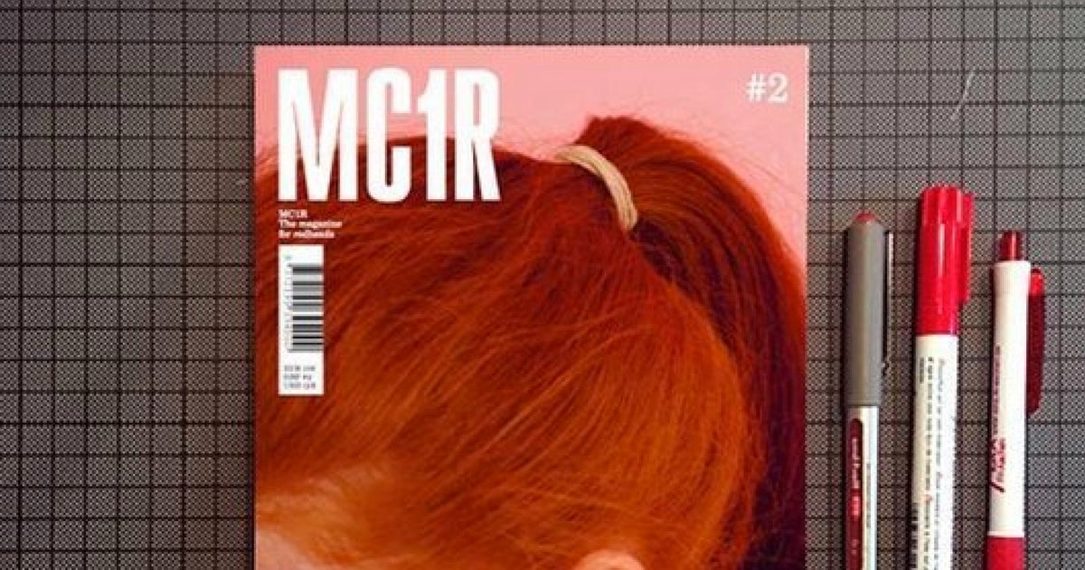 MC1R, Magazine Dedicated Entirely To Redheads, Proves Being Ginger Is ...