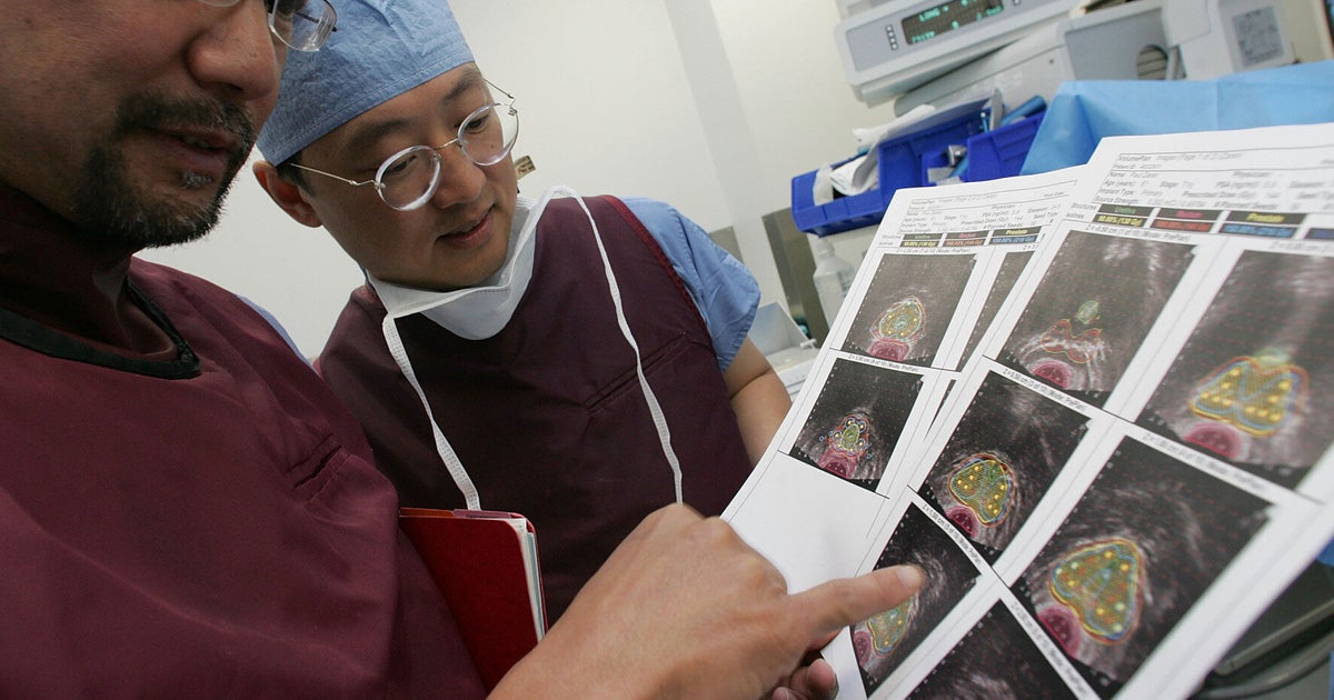 New And 'Less Invasive' Technique To Diagnose Prostate Cancer Is Being ...