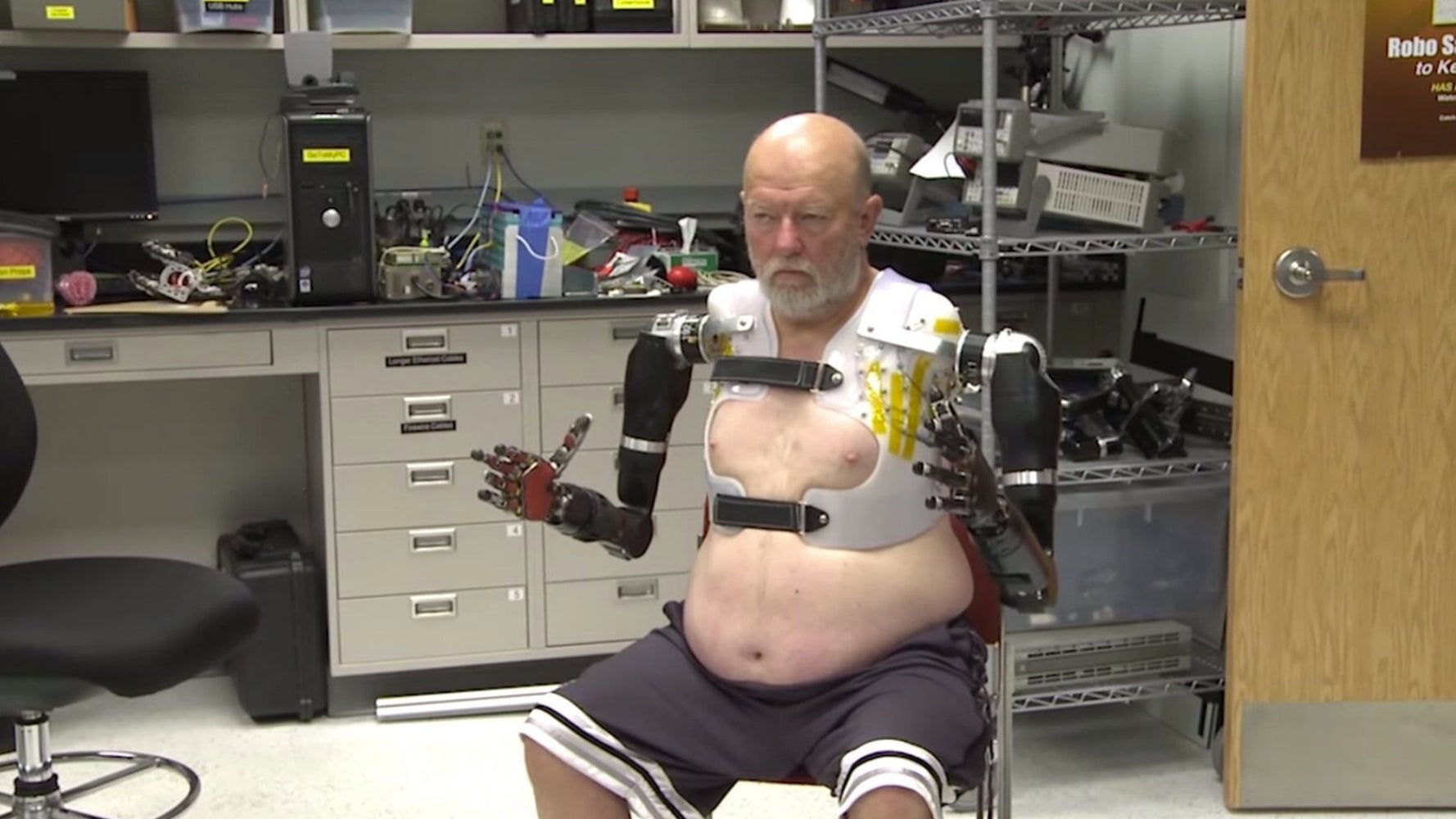 Amputee Successfully Controls Robotic Arms Using Just His Thoughts ...