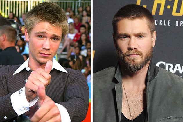Chad Michael Murray Before And After Nose Job