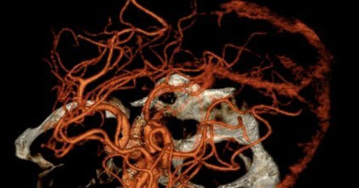 This Revolutionary New Body Scanner Is Disgustingly Amazing | HuffPost ...