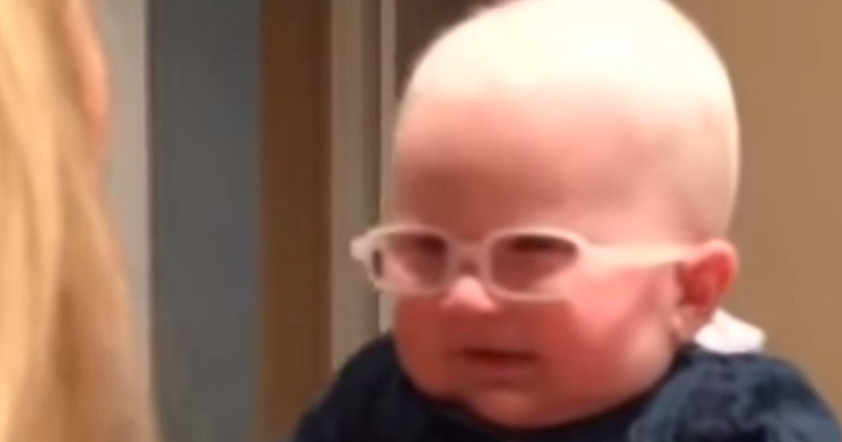 Baby Louise Sees Mum For The First Time After Being Born With Albinism ...