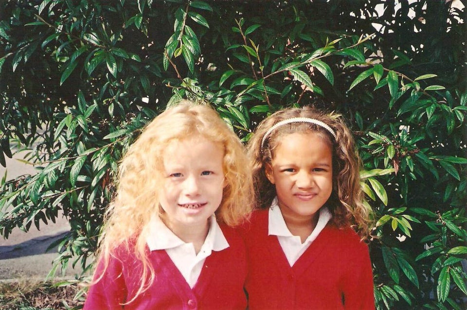 Can You Believe Theyre Twins Alymer Sisters Look Incredibly Different
