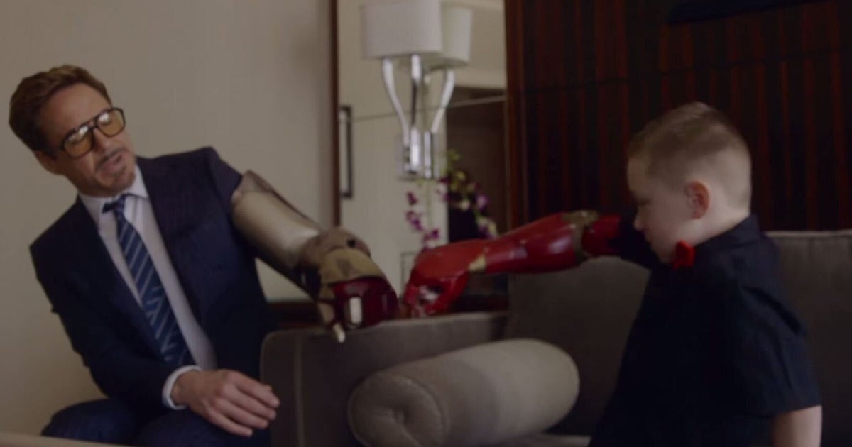 Robert Downey Jr. Gives Bionic 'Iron Man' Arm To 7-Year-Old Boy ...