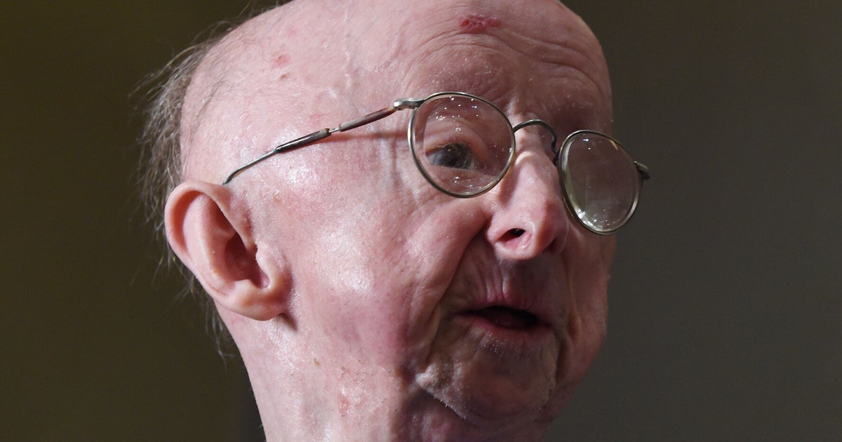 Alan Barnes' Mugger Richard Gatiss Jailed For Attack On Disabled ...