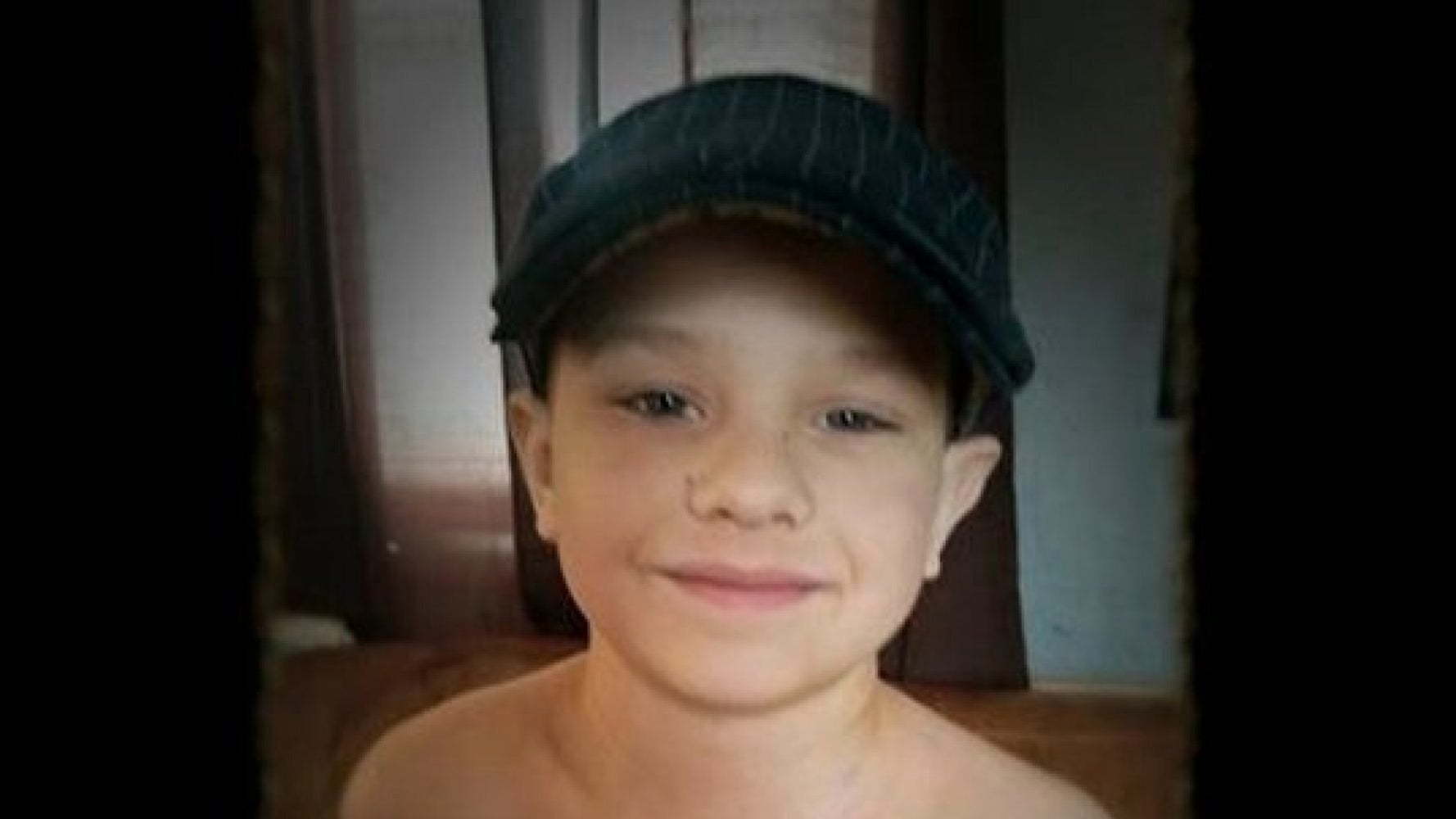 Little Boy With Heart Condition Discovers His 'Scars Are Beautiful ...