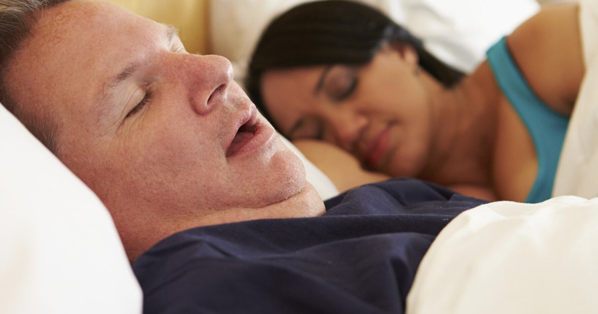 Snoring And Sleep Apnea Linked To Earlier Memory Loss And Decline In ...