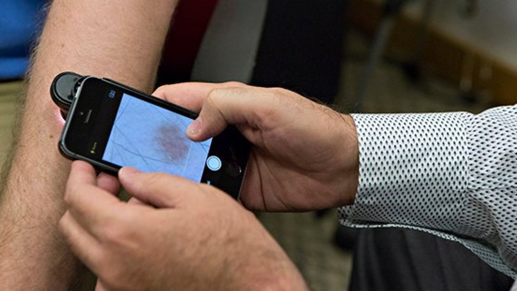 Dermoscan: This App Can Detect Skin Cancer | HuffPost UK Tech