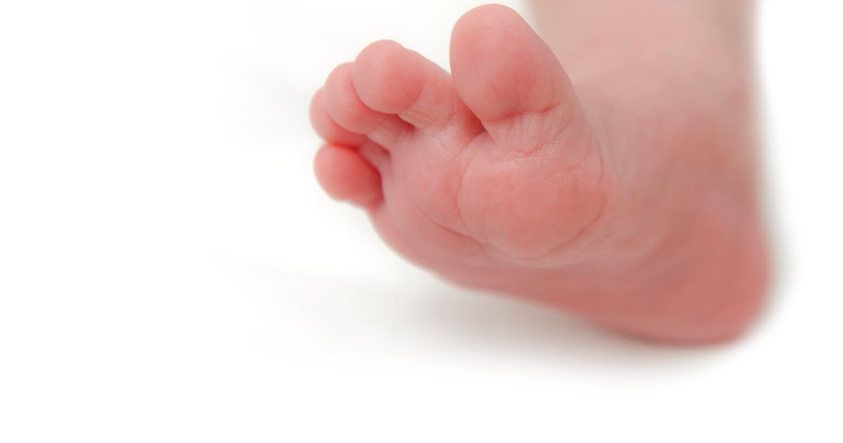 NHS 'Baby Death' Cover-Up Is Sickening, Say Parents Of Baby Amelia ...