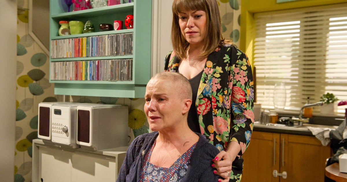 Emmerdale's Lesley Dunlop: 'Shaving My Head For Cancer Storyline Was A ...