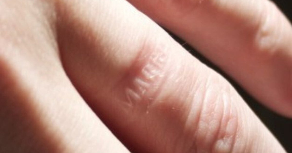 The Anti-Cheating Wedding Ring: Too Late For Tiger Woods, But Not For ...