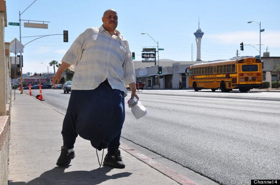 Tyrone Bowd, Australian Man With Watermelon-Sized Testicles Seeks ...