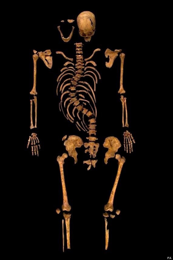 King Richard III's 'Hunchback' Was Exaggerated By William Shakespeare ...