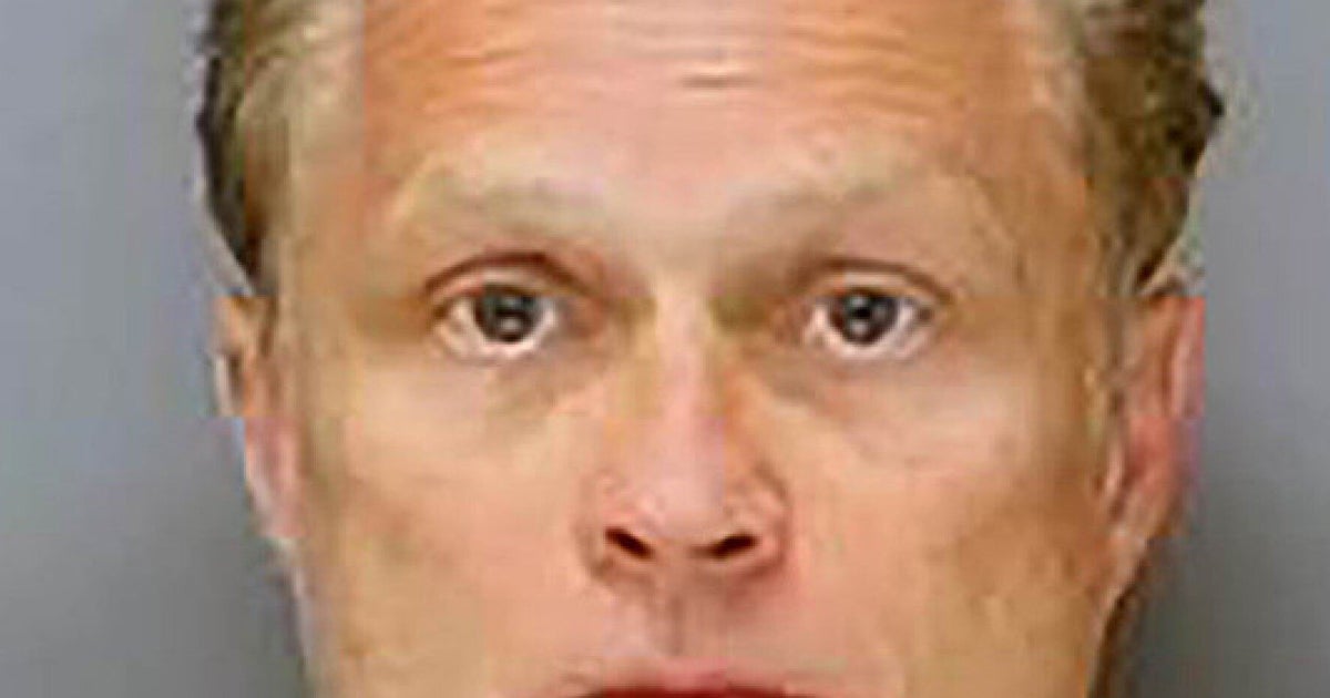Gary Dudek Accused Of Stealing $350,000 Of Human Skin From Philadelphia ...