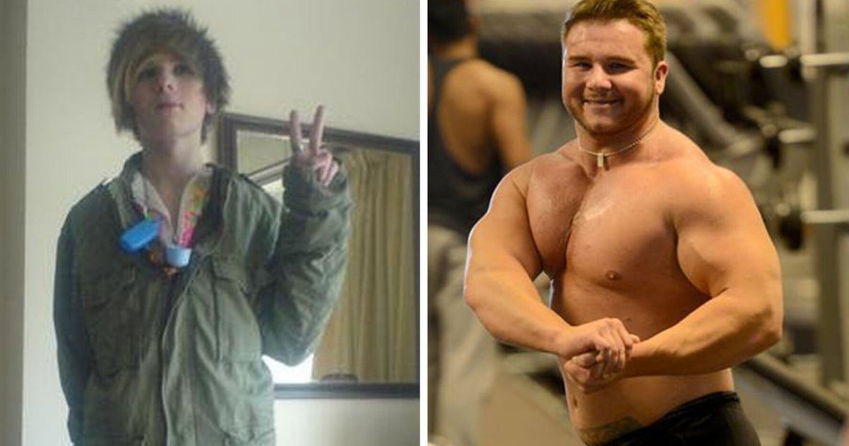 Former Anorexic Man Beats Eating Disorder To Become Bodybuilder ...