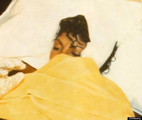 30 Years Ago Today... Michael Jackson Burned His Scalp During Pepsi ...