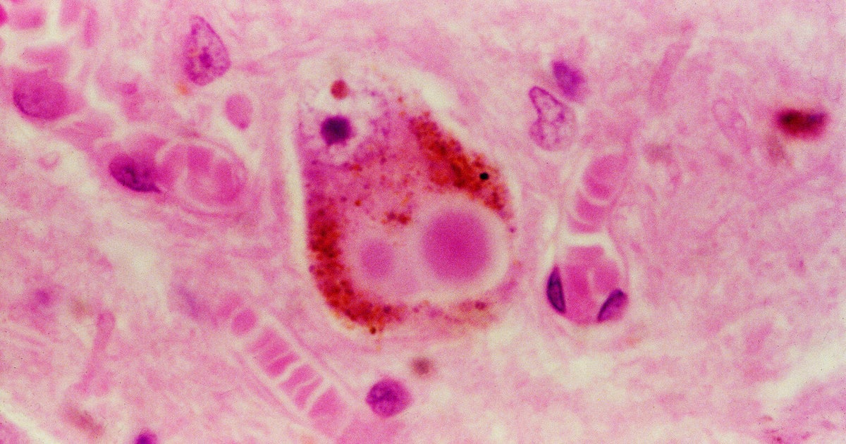 What Makes My Blood Boil? | HuffPost UK Life