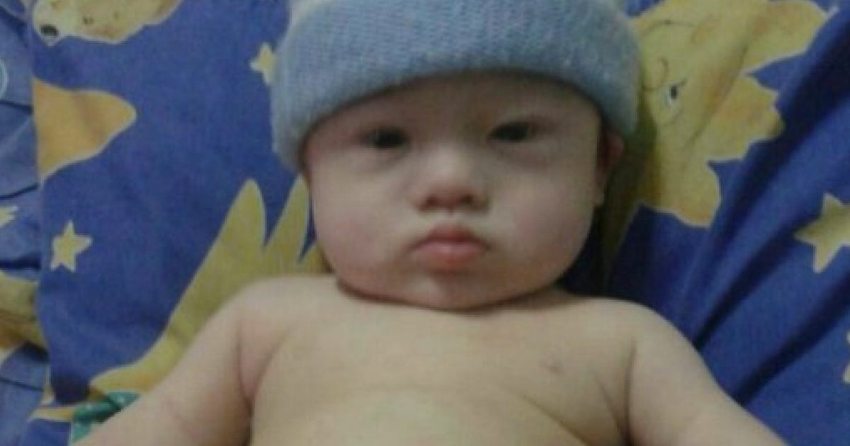 Gammy Parents David & Wendy Farnell Admit Of Down's Syndrome Son: 'We ...