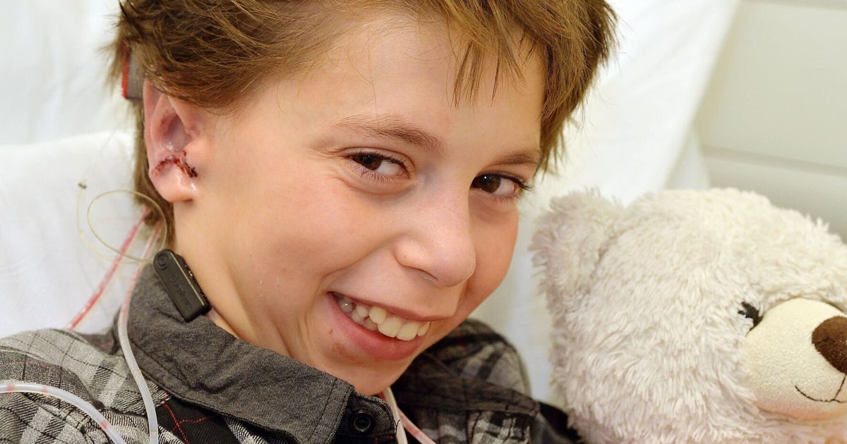 Boy Born Without Any Ears Has A Pair Created From His Own Ribs (VIDEO ...