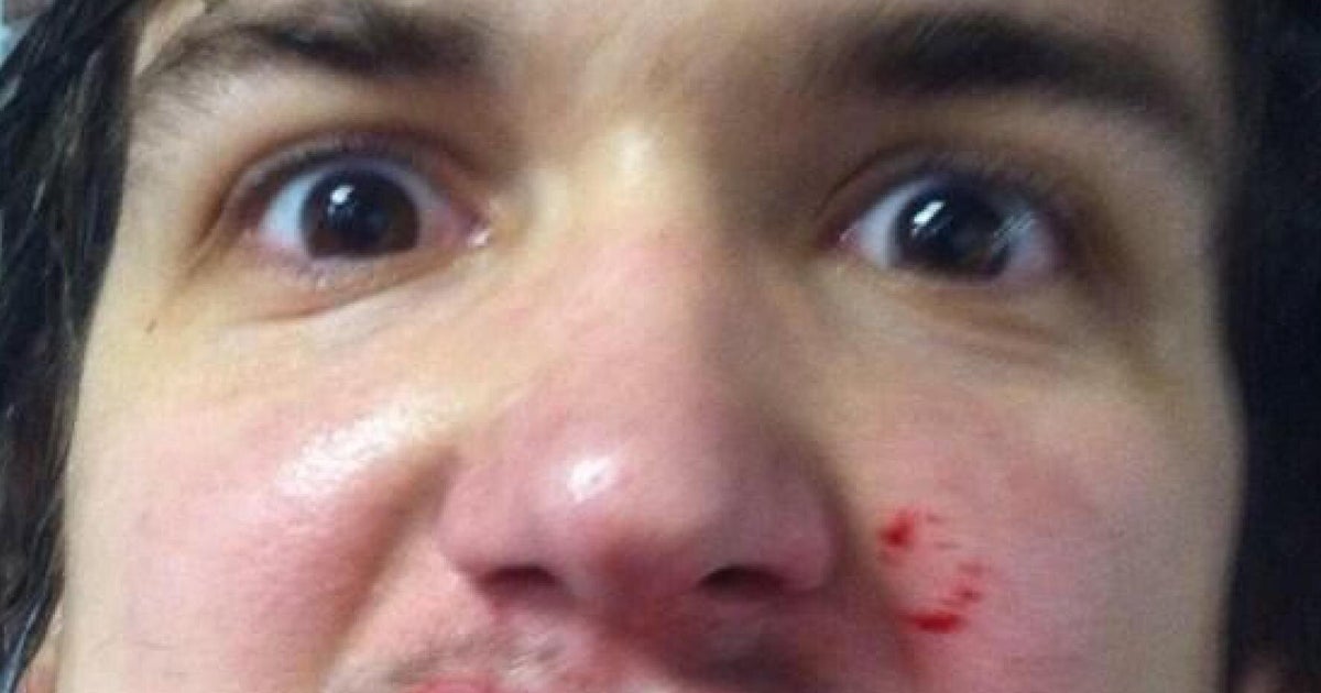 Mitch Callahan, Grand Rapids Ice Hockey Player, Hit By Puck To The ...