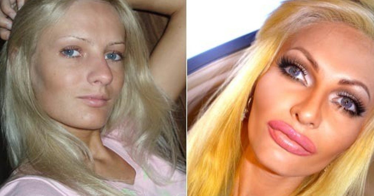 Model Spends Thousands On Plastic Surgery To Look Like A Sex Doll Says