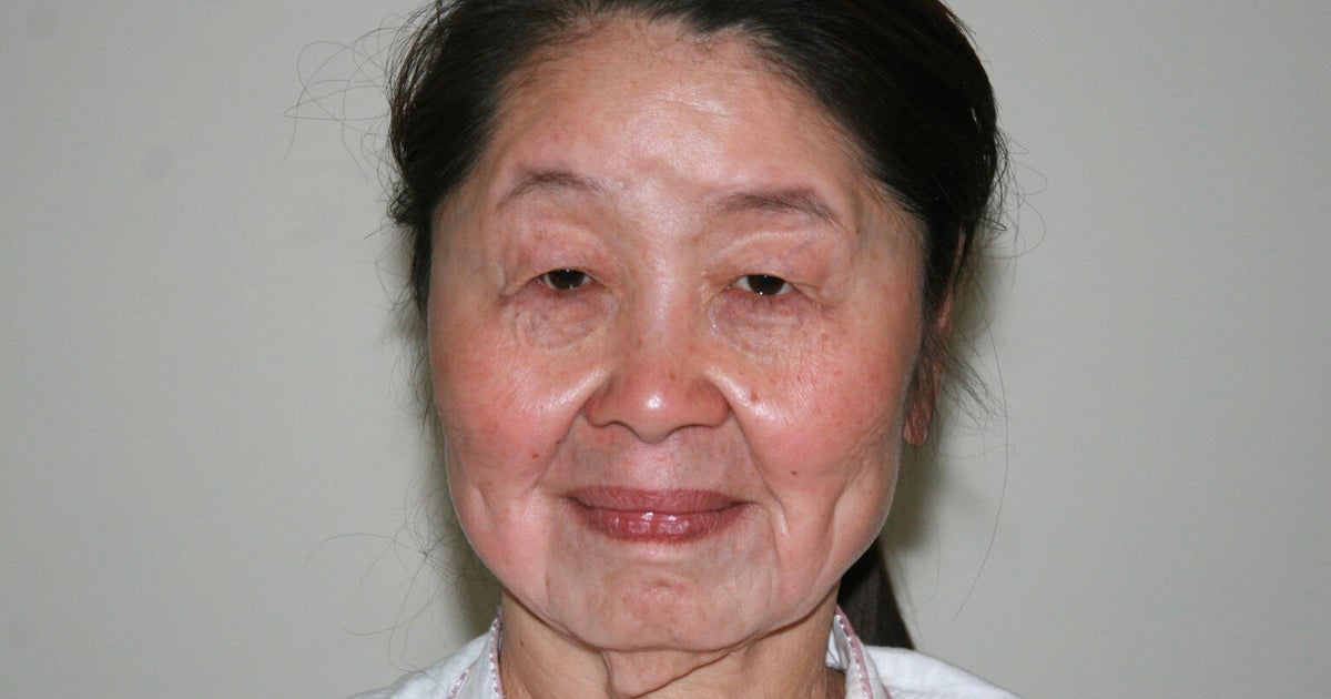 Chinese Woman, 28, Who Looks Like 80-Year-Old, Has Plastic Surgery ...