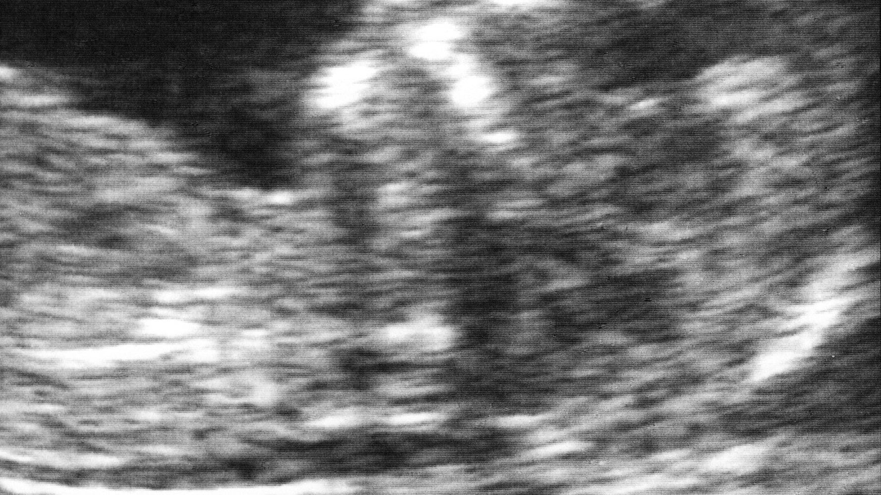 DNA Test Reveals If Future Parents Have 'Ginger Gene' (PICTURES Famous ...