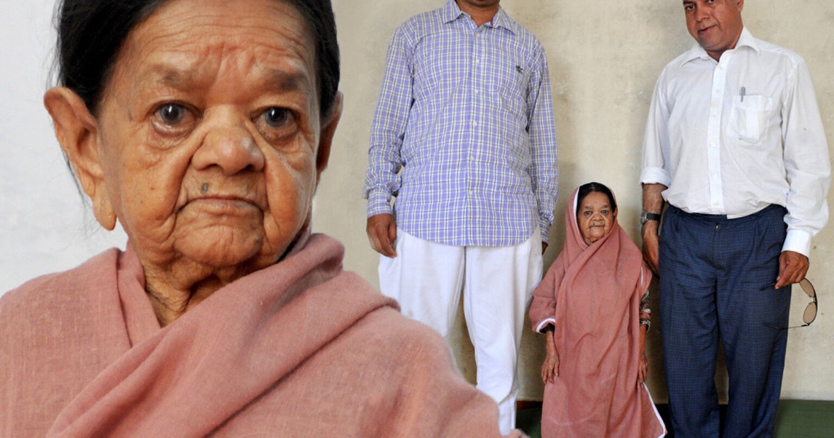 Zeenat Bi, Indian Woman Claims She Is World's Oldest Dwarf, Aged 113 ...