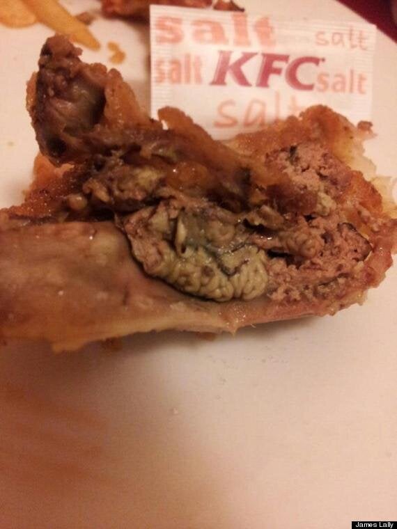 Student James Lally Finds Wrinkled Kidney 'Brain' In KFC Chicken Meal ...