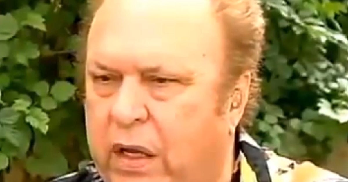 Man With Leaking Brain Fluid Thought He Just Had Allergies And A Runny