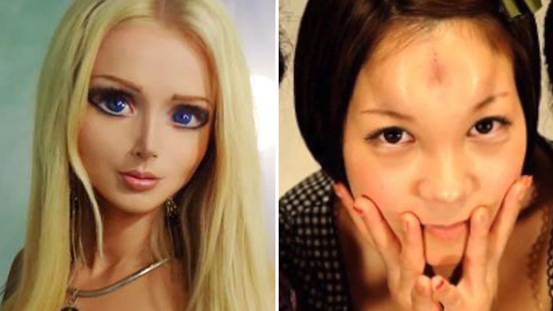 Unusual Beauty Crazes: From Human Barbie To Bagel Head Implants ...