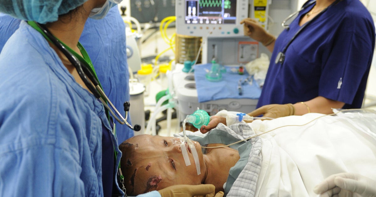 Roona Begum, Indian Girl With Severe Hydrocephalus, Has Life-Saving ...